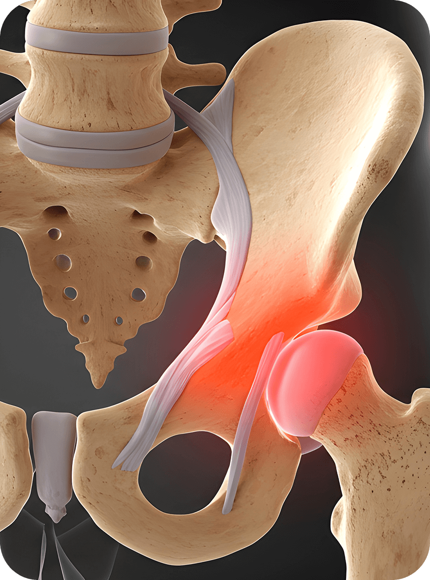 Sacroiliac (SI) Joint Injections | Innovative Pain and Wellness